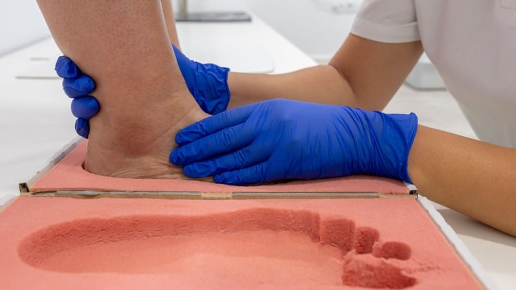 How to Take Foot Impressions for Fitting Custom Orthotic Insoles